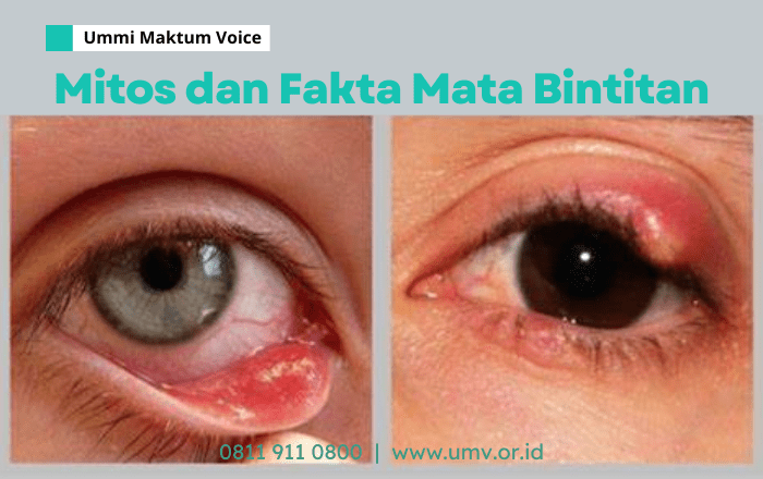 - Perkumpulan LSM UMMI MAKTUM VOICE